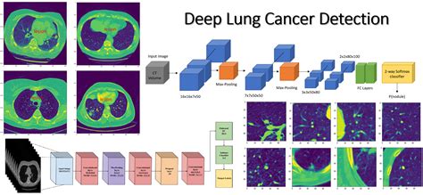 What Is Lung Cancer Pdf Chemotherapy Regimens Bjmo