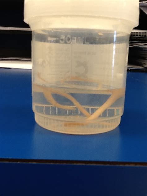 8 Pics Can Roundworms Live In Carpet And Review Alqu Blog