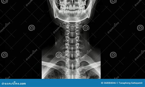 Human Vertebrae Diagram Infographics Vector Illustration 262090952