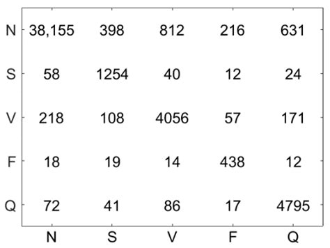 Discriminative Convolutional Sparse Coding Of Ecg Signals For Automated Recognition Of Cardiac