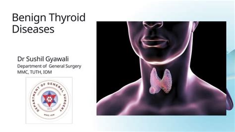 Benign Thyroid Diseases Hypothyroidism And Hyperthyroidism Graves