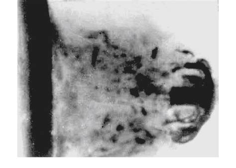 X Ray Pattern Of Penetration Into A B 4 C Ceramic Plate At A Time
