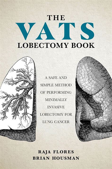 The Vats Lobectomy Book A Safe And Simple Method Of Performing
