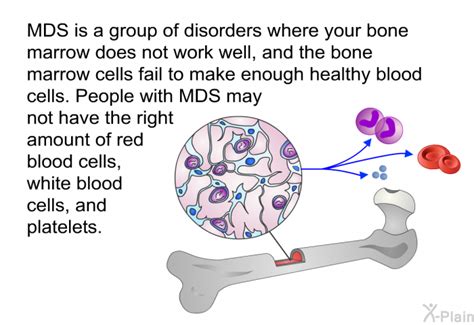PatEdu Com Myelodysplastic Syndromes Or MDS Overview