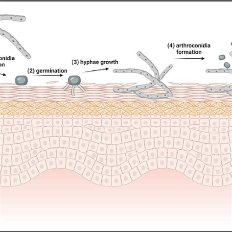 Classification Of Most Common Dermatophytes Causing Infections In Download Scientific Diagram