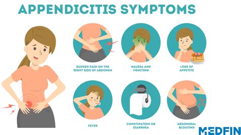 Appendicitis Causes Symptoms And Prevention Medfin