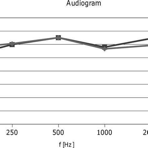 Average Values Of The Threshold Of Hearing Db Hl For The Tested