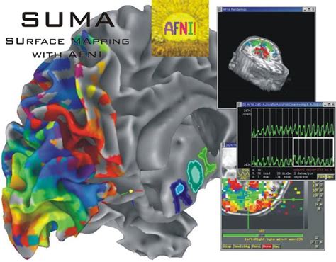 Afni Tutorial 9 Surface Based Analysis With Suma — Andys Brain Book 10 Documentation