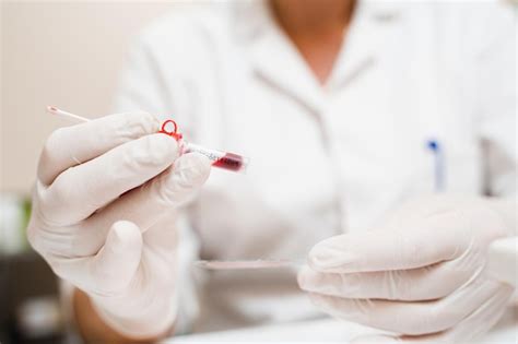 Premium Photo Laboratory Assistant Holds Test Tube Closeup For Gynecological And Cytological