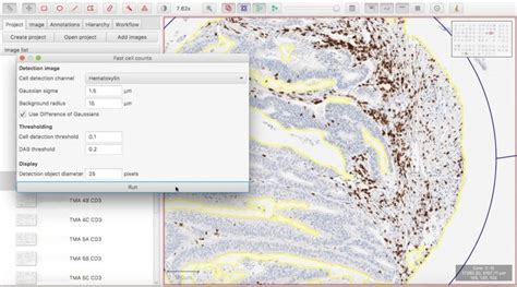 Tma Cd3 Analysis · Qupathqupath Wiki · Github