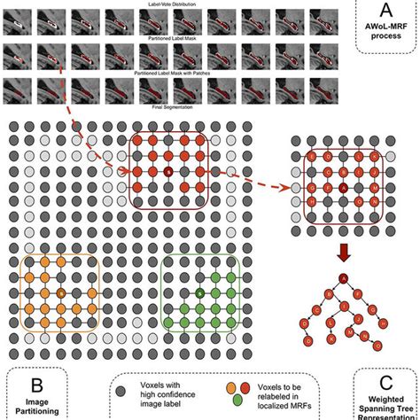 A The Segmentation Of A Sample Hippocampus In Sagittal View During Download Scientific Diagram