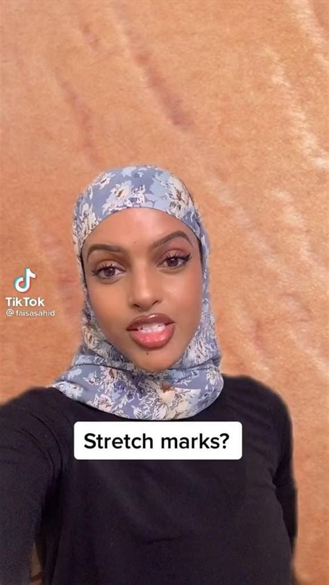 Stretch Marks Artofit