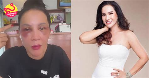 កុំច្រឡំថាប្ដីវ៉ៃ កាតុ បកស្រាយរឿងភ្នែកឡើងជាំទាំងសងខាង បន្ទាប់ពីបាត់មុខ ២ថ្ងៃ Sabay News