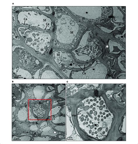 Transmission Electron Micrographs Of Cross Section Of Fruit Pith