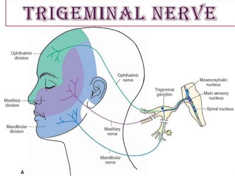 Trigeminal Neuralgia Presentation