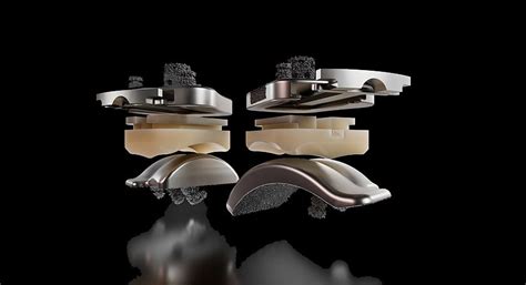 Exactech Gains 510 K For Activit E Polyethylene For Ankle Replacement