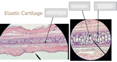 Elastic Cartilage Diagram Quizlet