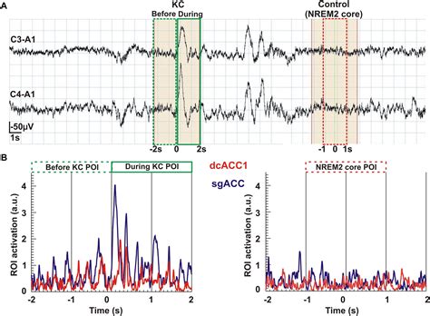 Frontiers Detection Of Eeg K Complexes Using Fractal 47 Off