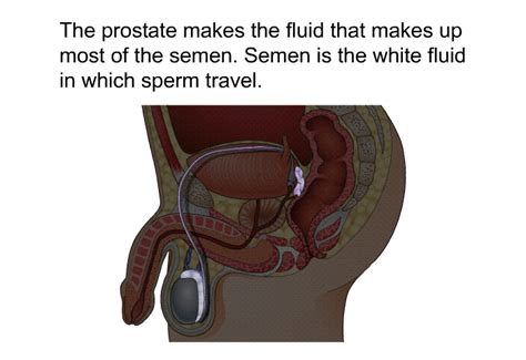 Prostate Diseases
