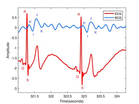 Bcg And Ecg Signals Of A Two Heart Cycle Download Scientific Diagram