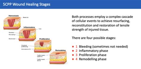 WOUND HEALING CPP Flashcards Quizlet