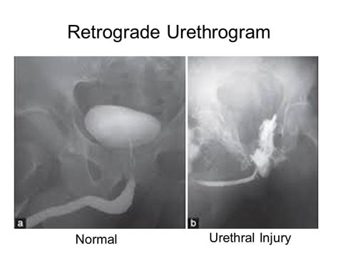 Ubc Department Of Urologic Sciences Lecture Series Ppt Video Online
