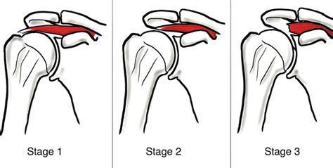 Gallery 3 — Dr Wael Bayoud