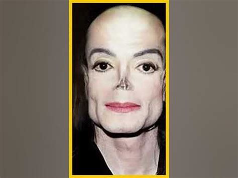 Michael Jackson SufriÓ Un Terrible Accidente En Un Comercial De Pepsi