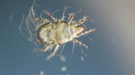 Mite Under Microscope