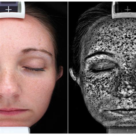 Example Of Before UV Camera Exposure Left Compared To UV Camera Photo Download Scientific