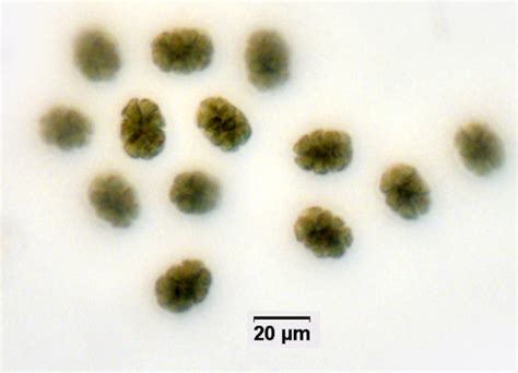 Phycokey Eudorina Aimages