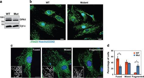 Opa1 Protein Level And Mitochondrial Morphology In Mefs Isolated From