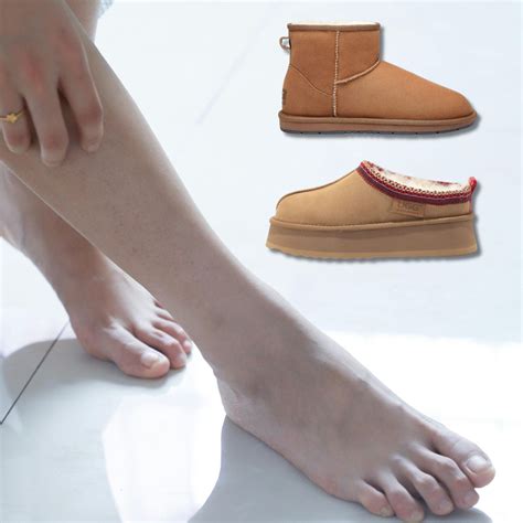 Ugg Boots For Flat Feet Are They Supportive Enough