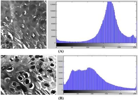 Contrast Enhanced Image With A Normal Tissue And Its Negatively Download Scientific Diagram