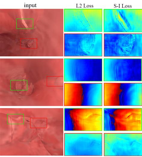 Effect After Improving Loss L Loss Loss Of Mean Square Error S L Download Scientific