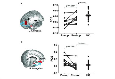 Normalization Of The Fcs Of Two Fronto Limbic Circuits After Download Scientific Diagram