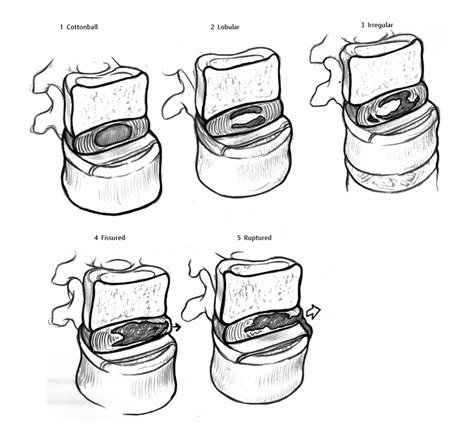 Provocative Testing Discography Neupsy Key