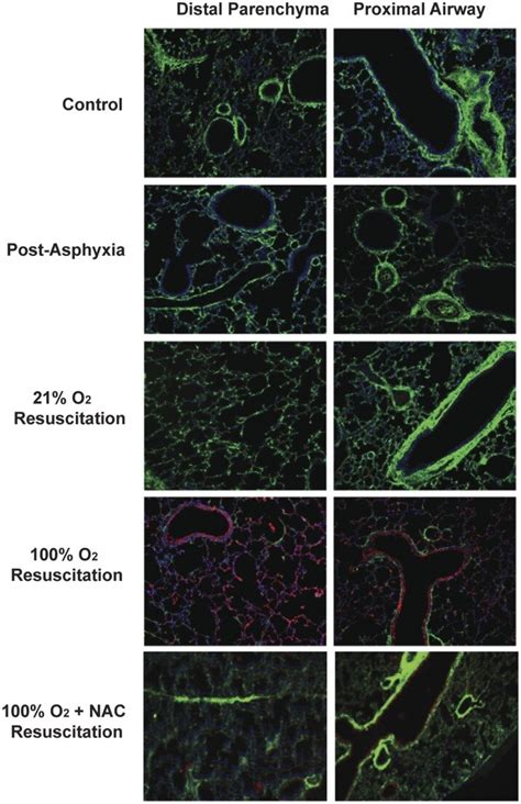 Formalin Fixed Paraffin Embedded Sections Of Inflated Lungs Were Download Scientific Diagram