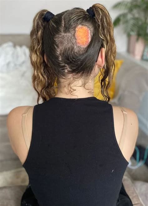 Fotos Impactantes Se Tiñó El Pelo Por Primera Vez Y Sufrió Quemaduras