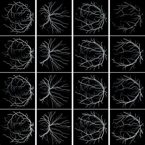 comparison of vessel segmentation results of existing algorithms with