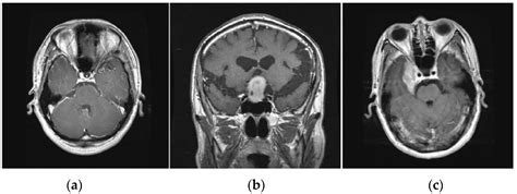 An Augmented Modulated Deep Learning Based Intelligent Predictive Model