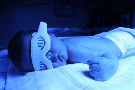 Eritroblastose Fetal Slide Set