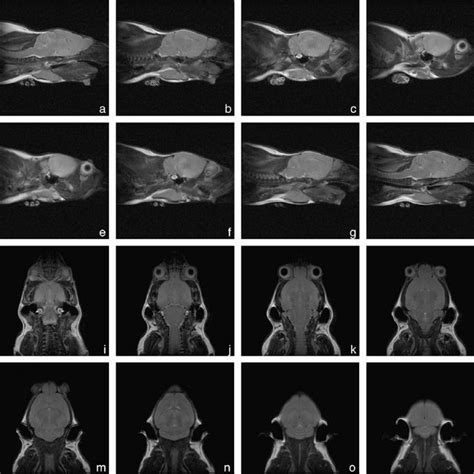 Anatomical Survey Of Bassoon Mutant Mice By T 2 Weighted Mri No