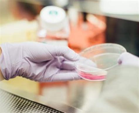 Urine Dutch Testing Dried Urine Hormone Profile Melbourne Natural
