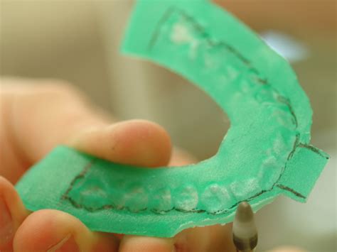 Centric Registration Base Plate Primotecusa