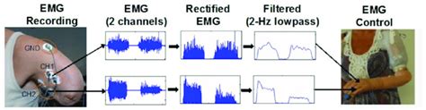 A Simple Control Strategy Of An Upper Limb Myoelectric Prosthesis By