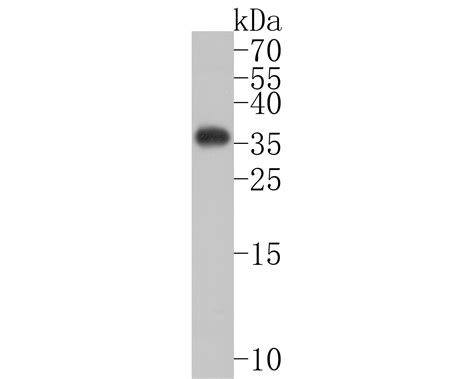Renilla Luciferase Recombinant Rabbit Monoclonal Antibody [sr07 830] Huabio