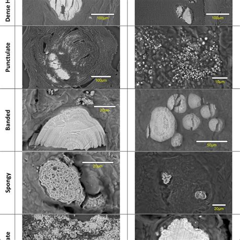sem images showing two examples typical of the five proposed morphology