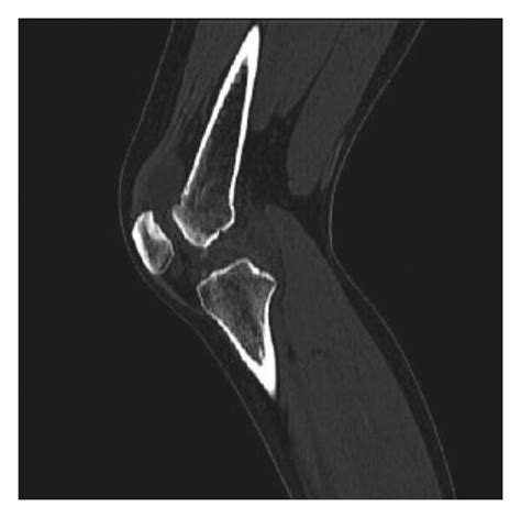 Results Of Ct Image Reconstruction With Different Algorithms Note A Download Scientific