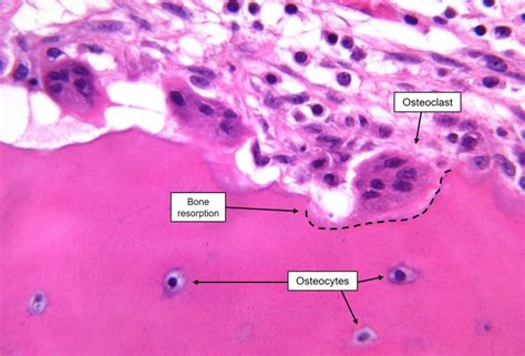 Osteoblasts Diagram